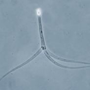 All Pathogens | Fish Pathogens